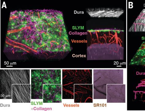 Khayum Mohammed Phd On Linkedin A Mesothelium Divides The Subarachnoid Space Into Functional