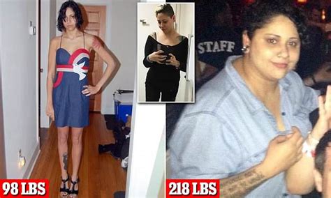 Anorexia Survivor Opens Up About Rare Hormonal Condition Daily Mail