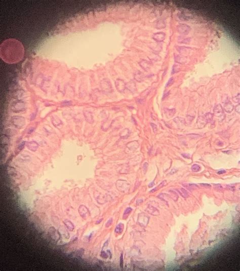 Simple Columnar Epithelium Tissue Histology Slides Ovaries Tissue