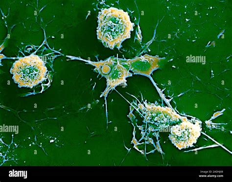 Multiple Sclerosis Coloured Scanning Electron Micrograph Sem Of Microglial Cells Round