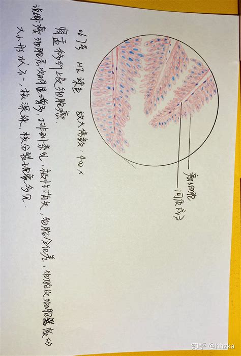 病理学切片红蓝铅手绘图 知乎