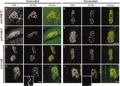 Figure 1 From Disruption Of Trkb Mediated Signaling Induces Disassembly Of Postsynaptic Receptor