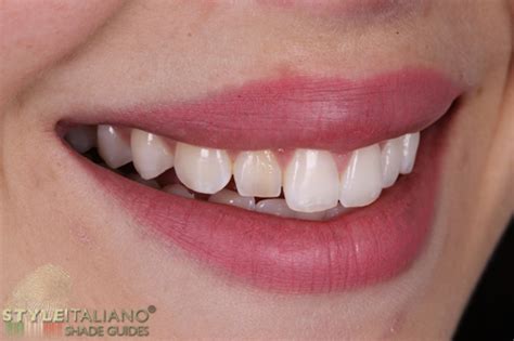 Brb Matrix A Simple Way To Produce Lingual Matrix