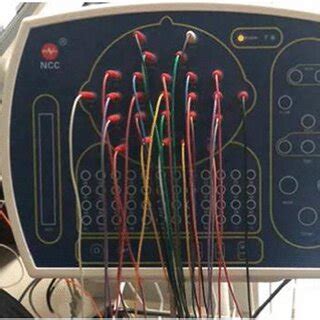 Multiple Input Single Output EEG Collection Model Download Scientific Diagram