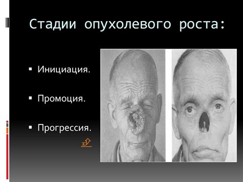 Опухоль Доброкачественные и злокачественные опухоли презентация онлайн