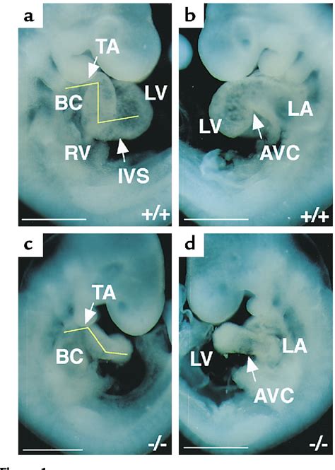 Figure 1 From The Polycomb Group Gene Rae28 Sustains Nkx2 5 Csx Expression And Is Essential For