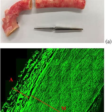 Specimen Preparation And Microscopy Imaging A Thoracic Aorta From