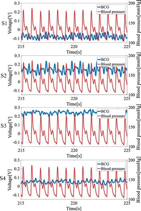 Figure 2 From A Practical Bcg Measuring System With Bed Sensors And