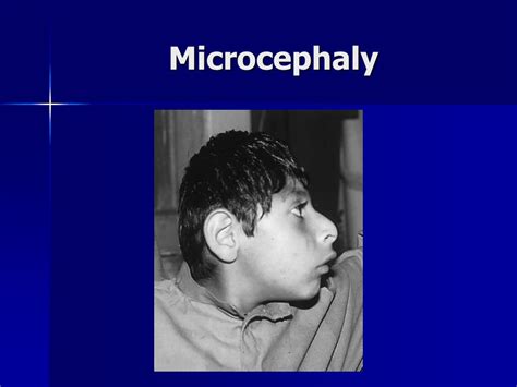 Ppt Mental Retardation Powerpoint Presentation Free Download Id