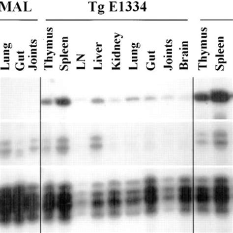 S1 Nuclease Protection Analysis Of Total Rna From Tissues Of Normal
