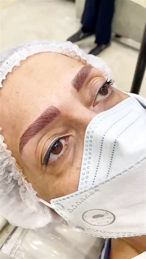 فیبروز ابرو