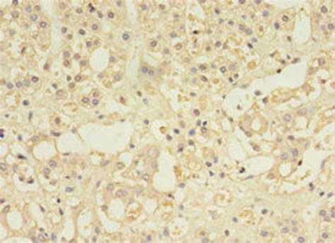 Anti Mycbp 抗体 Paco40218 Ihc