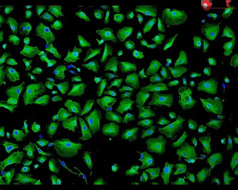 Epithelial Cells Lung Epithelial Cells Coordinate Innate Lymphocytes