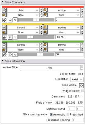 Modules Slices Documentation Slicer Wiki