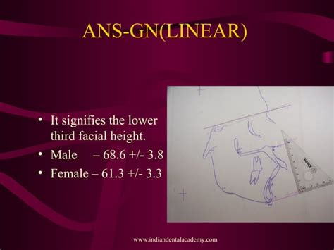 COGS Analysis Cephelometrics For Orthognathic Surgery Fixed Orthodontics Courses India PPT