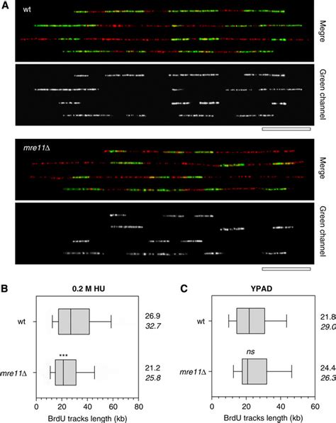 Mre11 Is Required For Normal Replication Fork Progression In The Download Scientific Diagram
