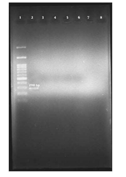 Frequency Of Cytolethal Distending Toxin Genes In Escherichia Coli Isolates From Bovine Mastitis
