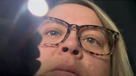 Asmr Laser Removal Of Skin Tags Surgery Medical Doctor Exam Roleplay Relaxing And Tingly