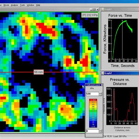 Contact Pressure Distribution And Contact Pressure Profile Underneath