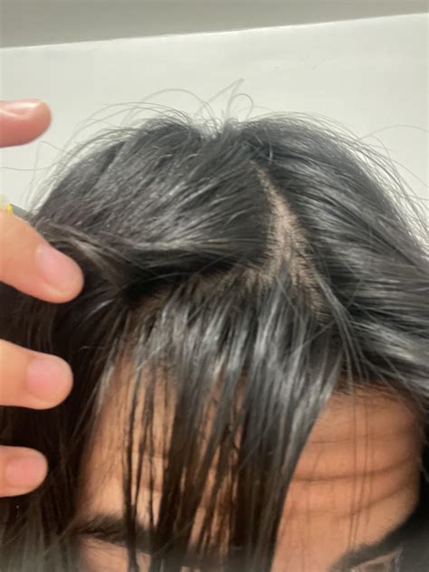 Hair Is Separating Rhair