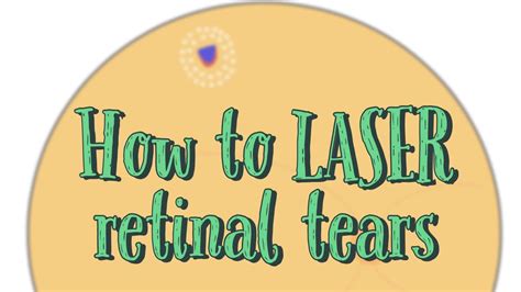 Retinal Tear Laser Surgery Complete Guide Youtube