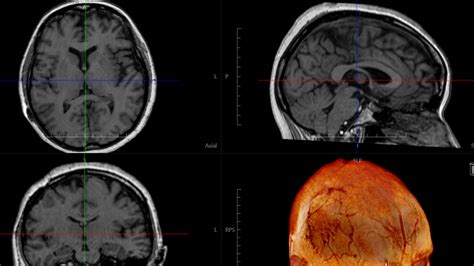 What Is DICOM And What Are Its Basics Basic Life Hacks Health