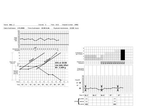 Use Of Partogram In Labour Management