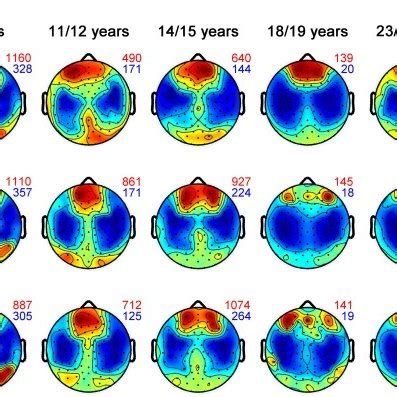 The Photo Shows An 11 Year Old Subject Wearing A High Density EEG Net Download Scientific