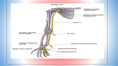 Ulnar Nerve Stimulation Pptx
