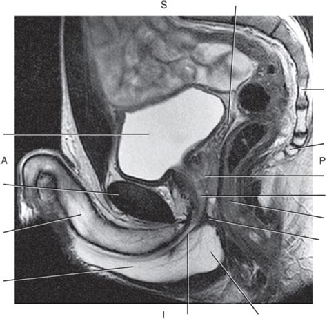 Male Pelvic Cavity Labeling Biology Terms And Definitions Flashcards