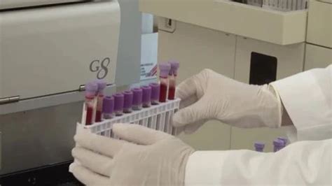 Tosoh Fully Automatic Automated Glycohemoglobin Analyzer Hlc 723g8 For Hospital And