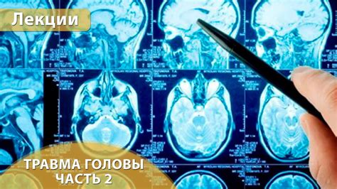 Часть 2 Компьютерная томография при травме головы Андрей Мангов Youtube