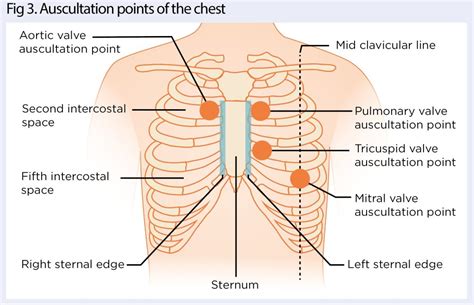 How To Conduct A Cardiovascular Assessment In Advanced Practice