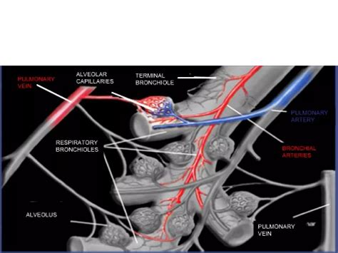 Bronchiectasis Ppt