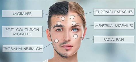 Supratrochlear Nerve Block