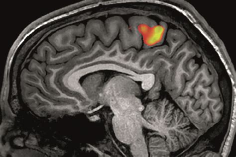 brain fmri scan