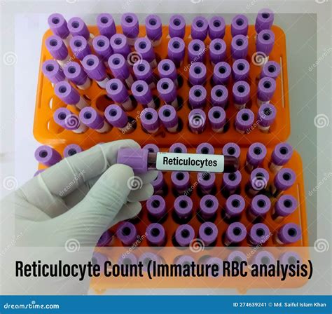 Labcorp Test Code For Reticulocyte Count At Gabrielle Pillinger Blog