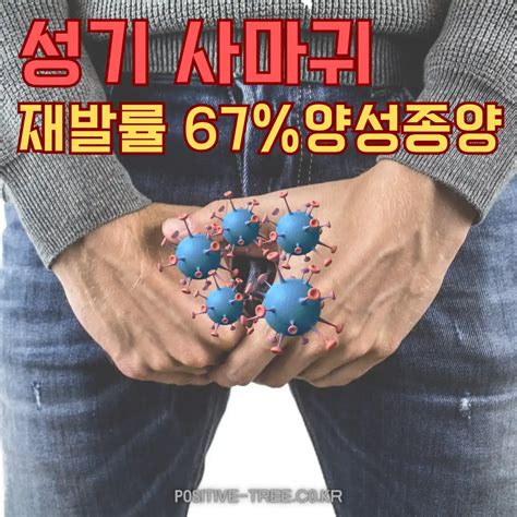 성기 사마귀 재발률이 67 양성 종양 입니다