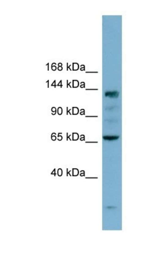 Isoleucyl Trna Synthetase Rabbit Anti Human Polyclonal Novus