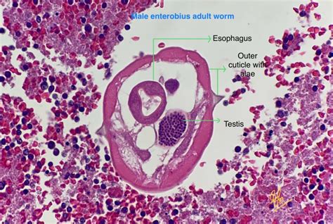 Fatima Shamsuddin On Linkedin Answer To The Previous Spotter