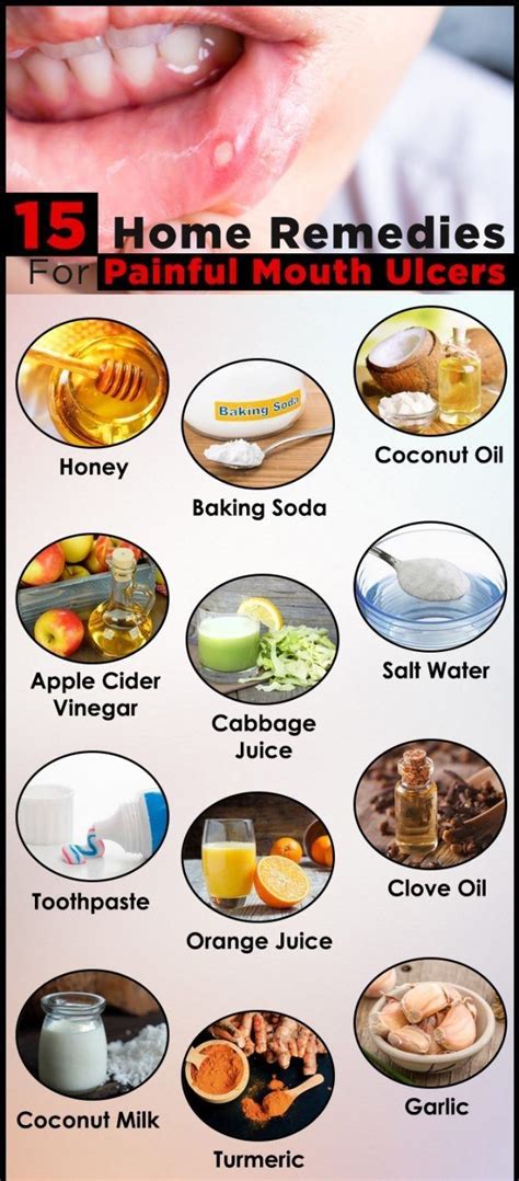 Healing Mouth Sores Naturally