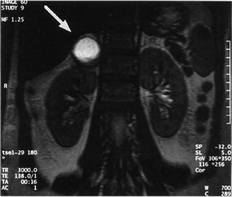 Physiology Of The Sympathoadrenal System Basicmedical Key
