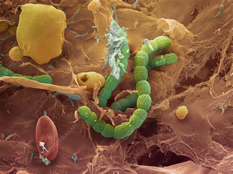Bacteria Sem Stock Image C030 4891 Science Photo Library