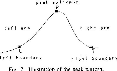 Figure 1 From Syntactic Pattern Recognition Of The ECG Semantic Scholar