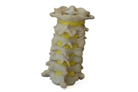 Hypermobility Cervical Spine Model Understanding Cervical Spine