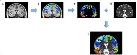 Cortical Parcellation And Measurement Of Cortical Md Each T1 Image A Download Scientific
