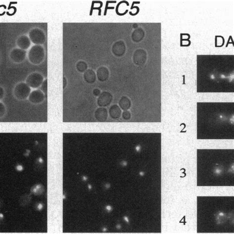 Nuclear And Spindle Morphologies A Photographs Of Dapi Stained