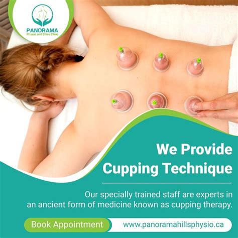Cupping Technique Massage Panoramahillsphysio