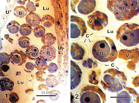 Differential Interference Contrast Light Micrographs Of The Gravid