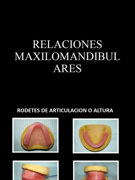 Relaciones Intermaxilares Pdf Dentadura Postiza Articulación